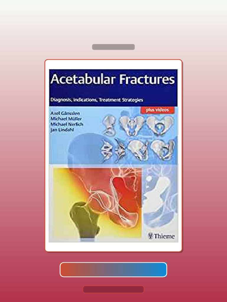 Acetabular Fractures Diagnosis Indications Treatment Strategies ...