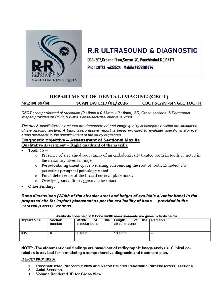 CBCT Scan Report for Tooth 15 Analysis | PDF