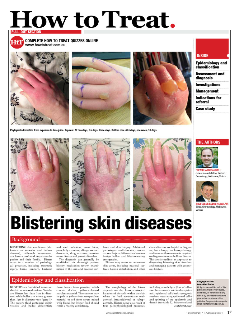 Skin Blistering Skin Diseases | PDF | Serology | Dermatology