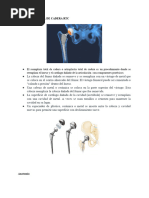 Cerclaje de Rótula: Técnica Quirúrgica | PDF | Articulación | Rodilla