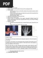 Hand X-Ray Projections Guide | PDF | Hand | Finger