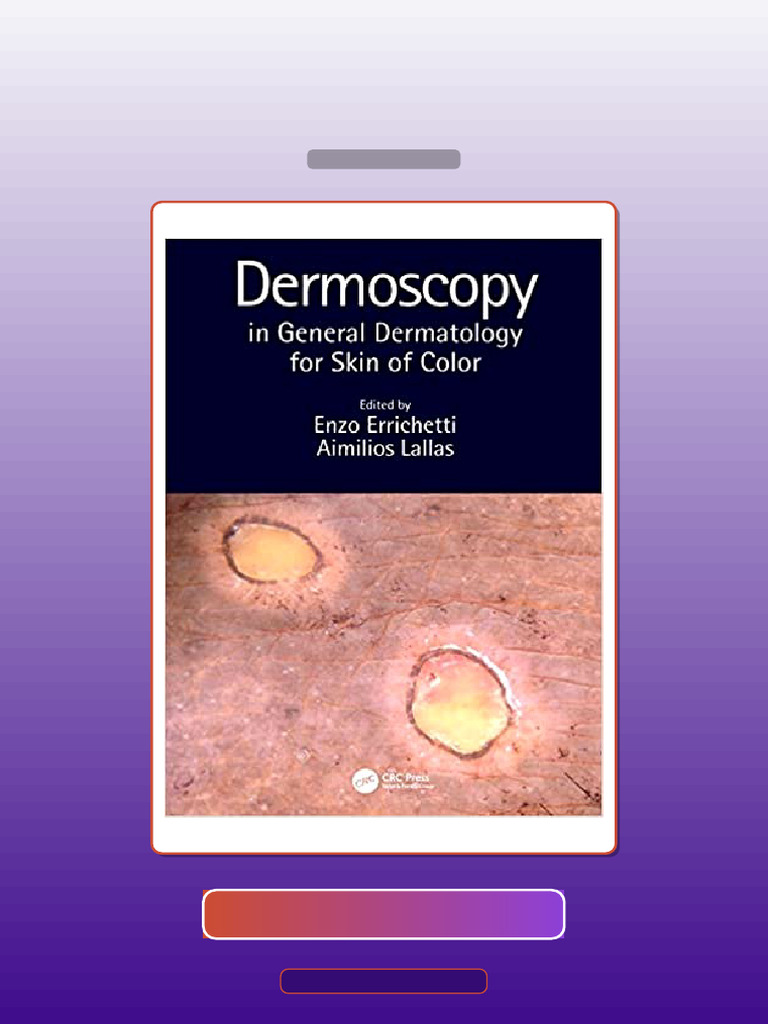 Dermoscopy in General Dermatology for Skin of Color by Enzo Errichetti ...