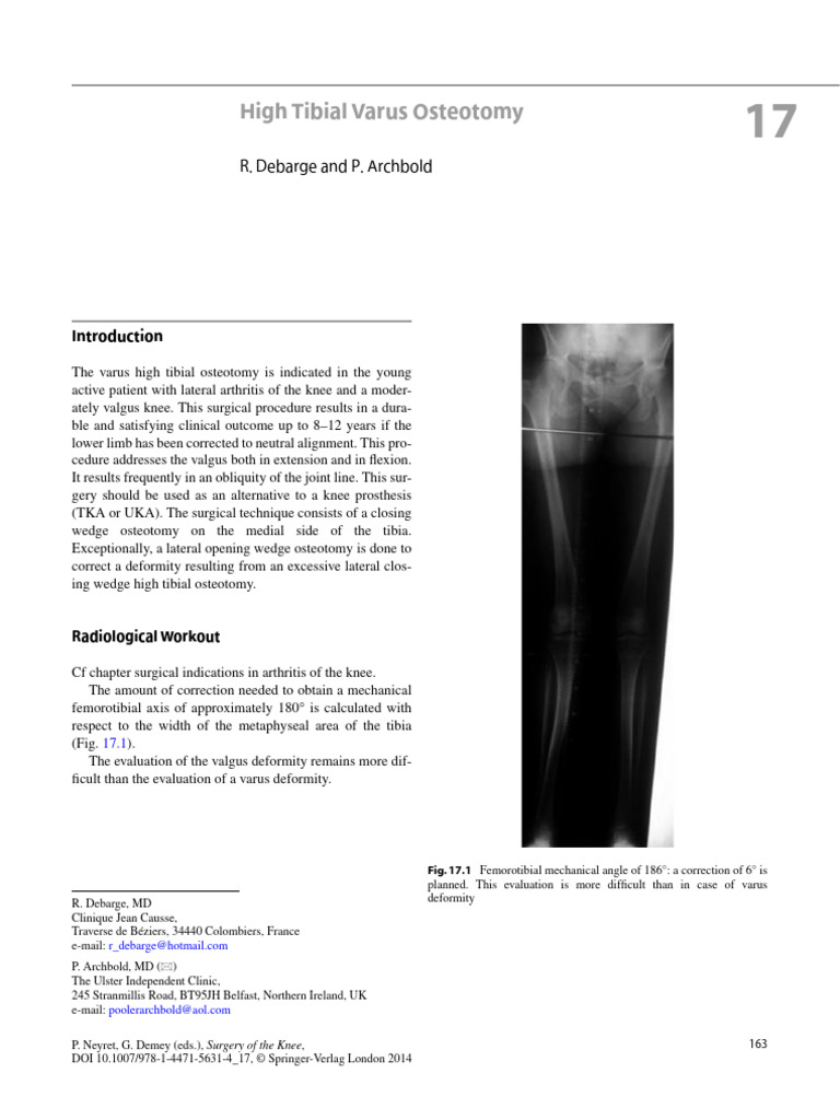 BC Surgery of The Knee 17 High Tibial Varus Osteotomy | PDF | Knee ...