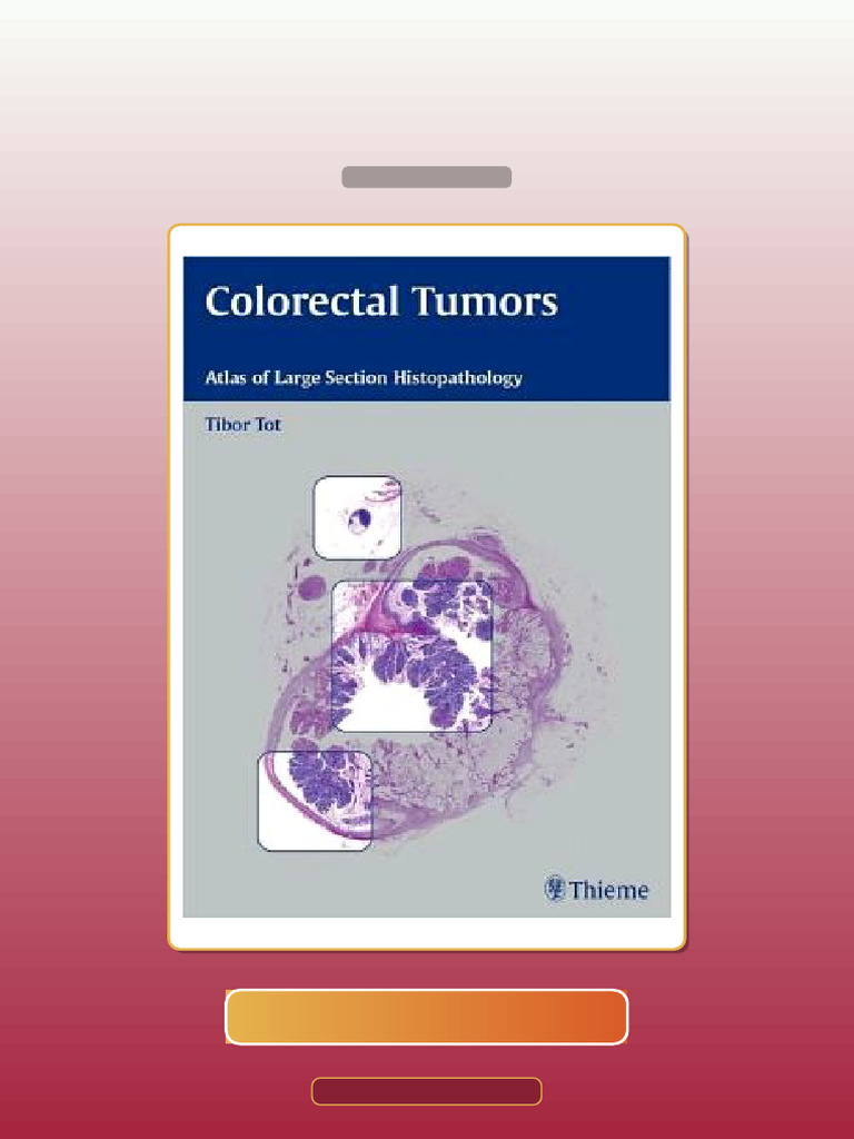 Colorectal Tumors Atlas of Large Section Histopathology E-book Testbank ...