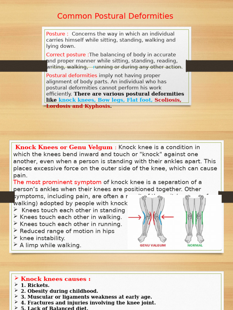 Common Postural Deformities | PDF | Foot | Knee