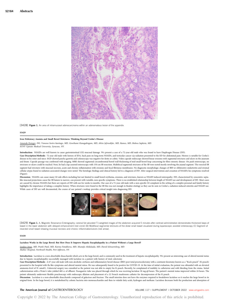 s3429 Iron Deficiency Anemia and Small Bowel.3429 | PDF | Crohn's ...