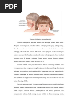 Parotitis: Gejala, Penyebab, dan Pengobatan | PDF