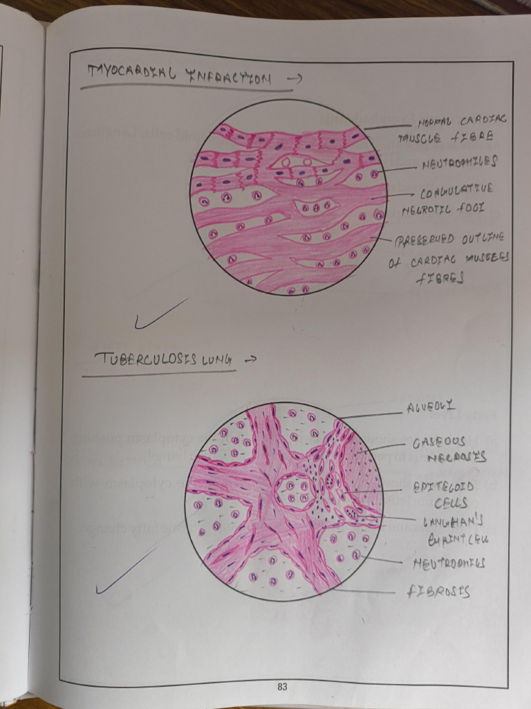 Pathology PDF 1 | PDF