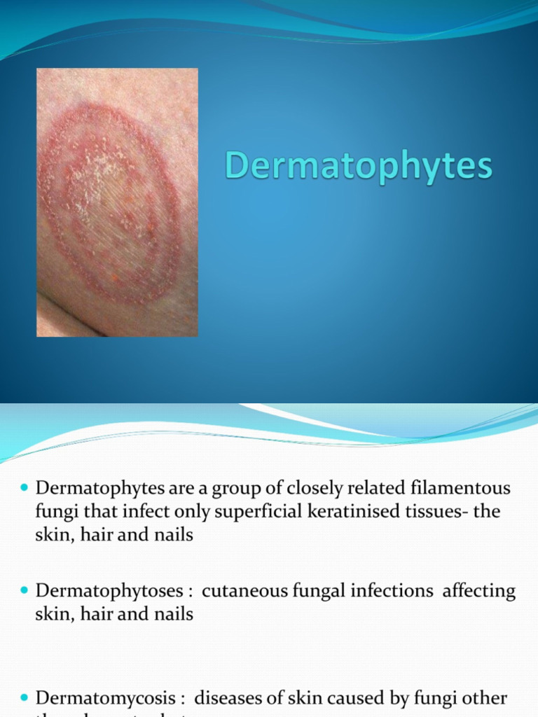 Dermatophyts PDF | PDF