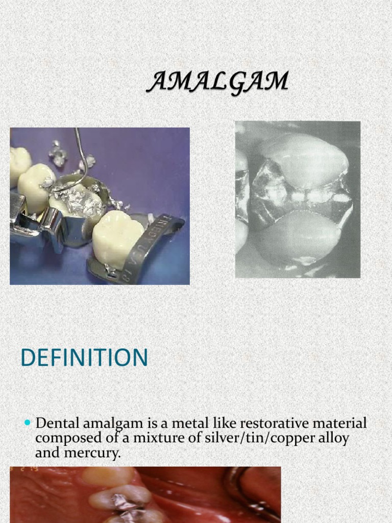 Amalgam Pdf Dental Anatomy Mouth