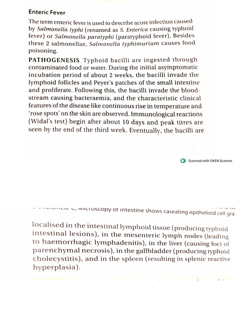 Typhoid Fever | PDF