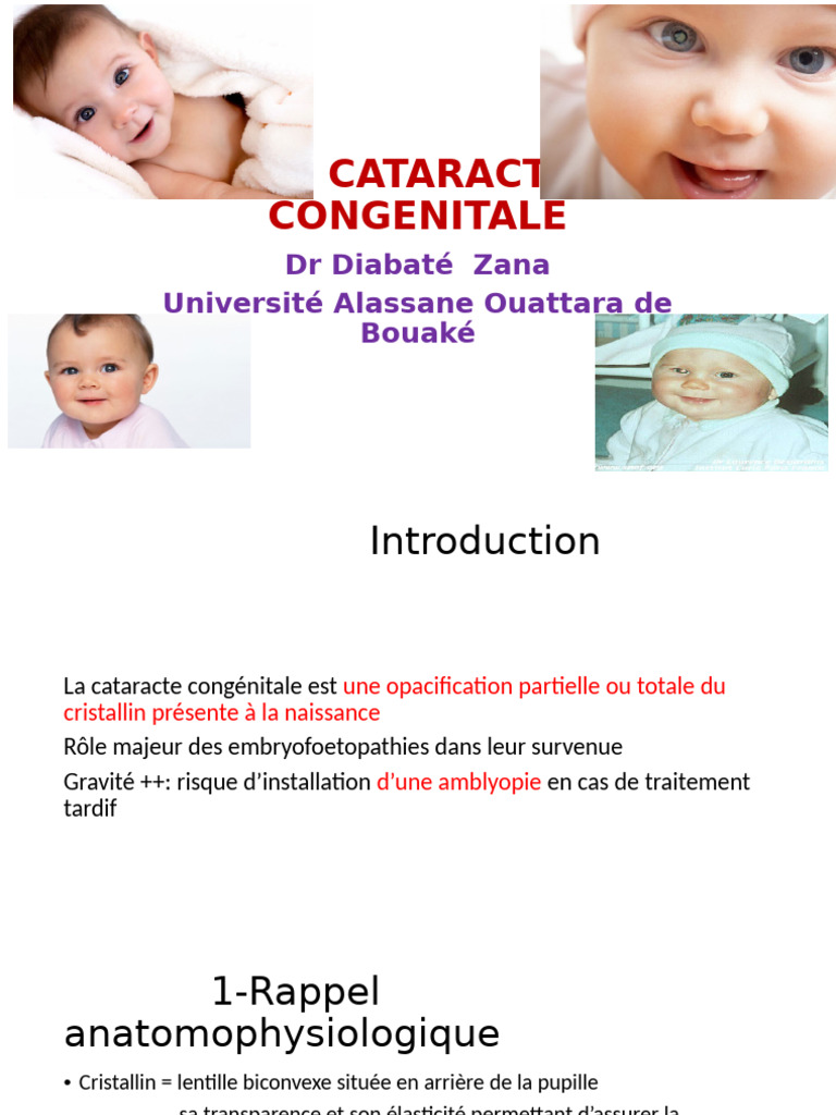 Cataracte Congenitale | PDF | Cataracte | Œil humain