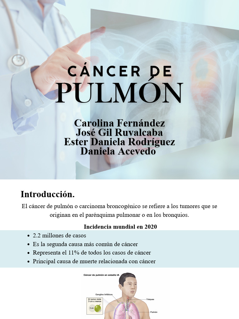 Cá Pulmón | PDF | Cáncer de pulmón | Cáncer