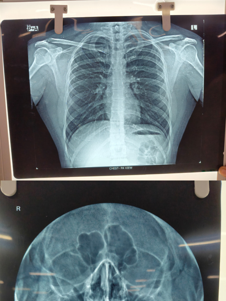 Radiology (Thorax + Head and Neck) | PDF