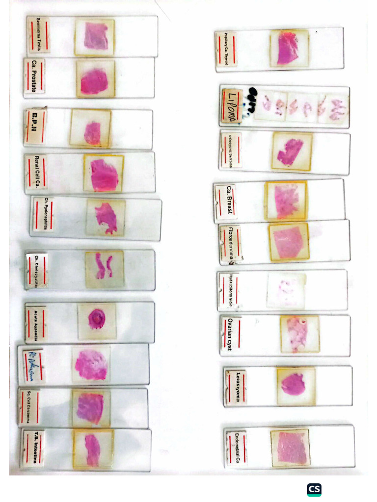 Special Patho SMC Slides | PDF