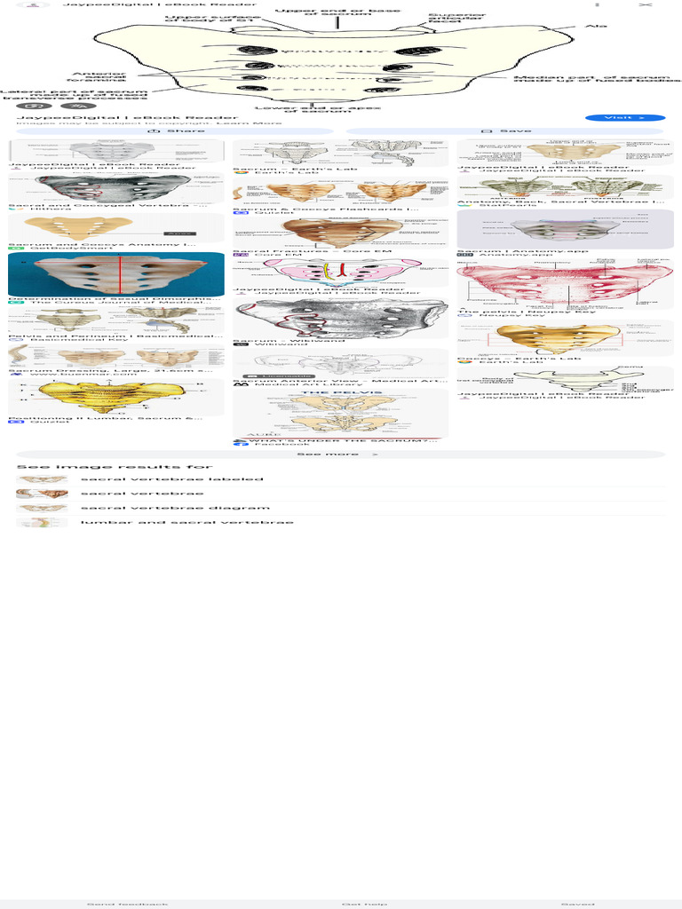 Typical Sacral Vertebrae - Google Search | PDF | Vertebra ...