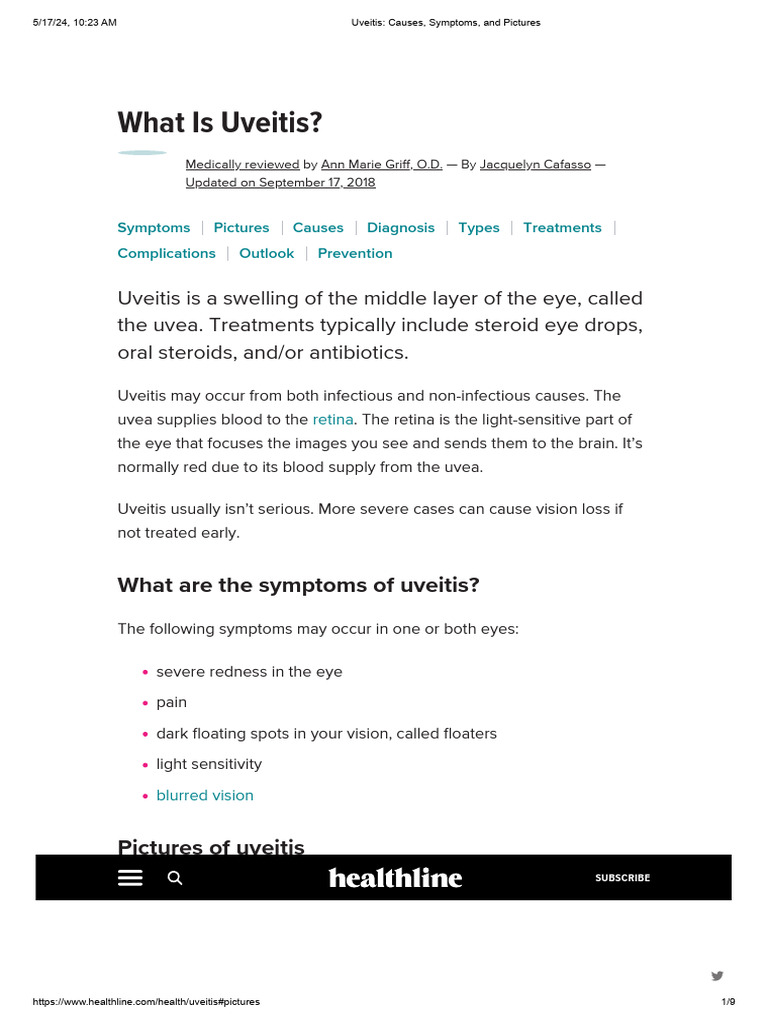 Uveitis - Causes, Symptoms, and Pictures | PDF | Immunology | Human ...