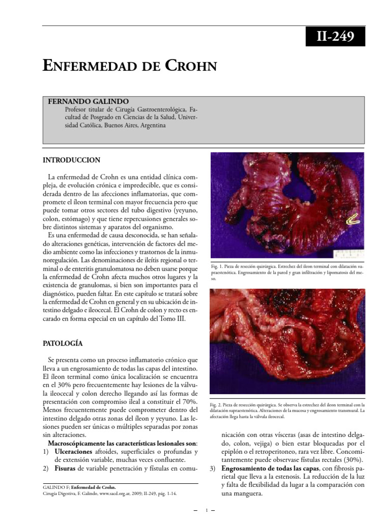 Enfermedad de Crohn 2 | PDF | Enfermedad de Crohn | Tracto gastrointestinal