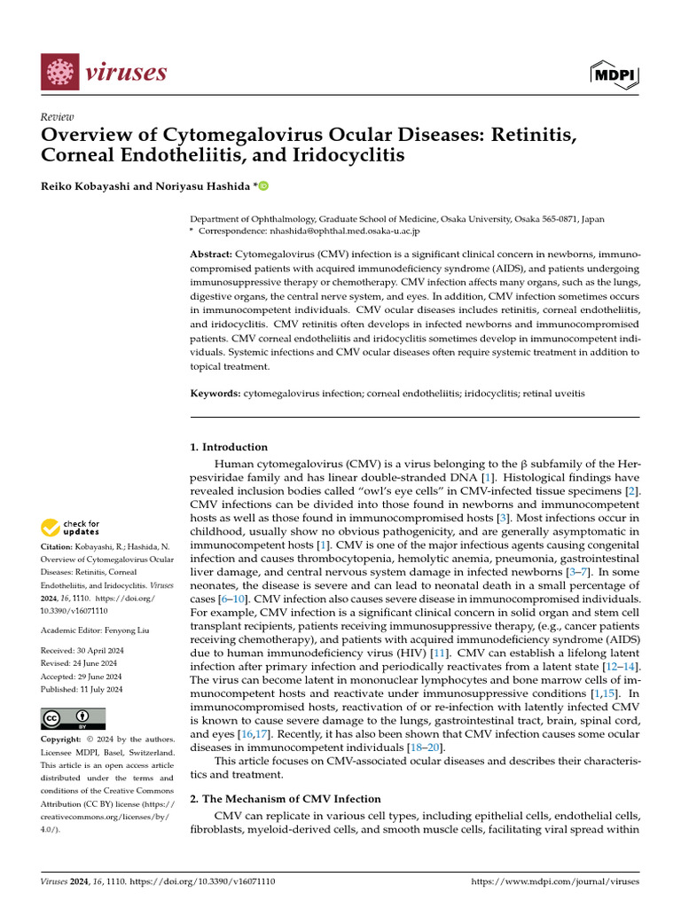 Overview of Cytomegalovirus Ocular Diseases Retinitis, Corneal ...