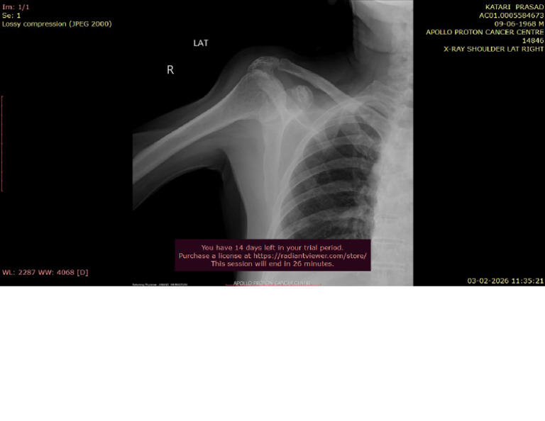 Shoulder LAT | PDF