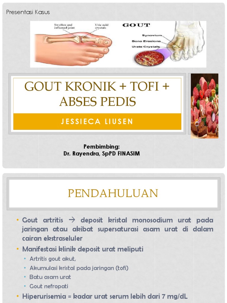 Gout Kronik + Tofi + Abses Pedis | PDF