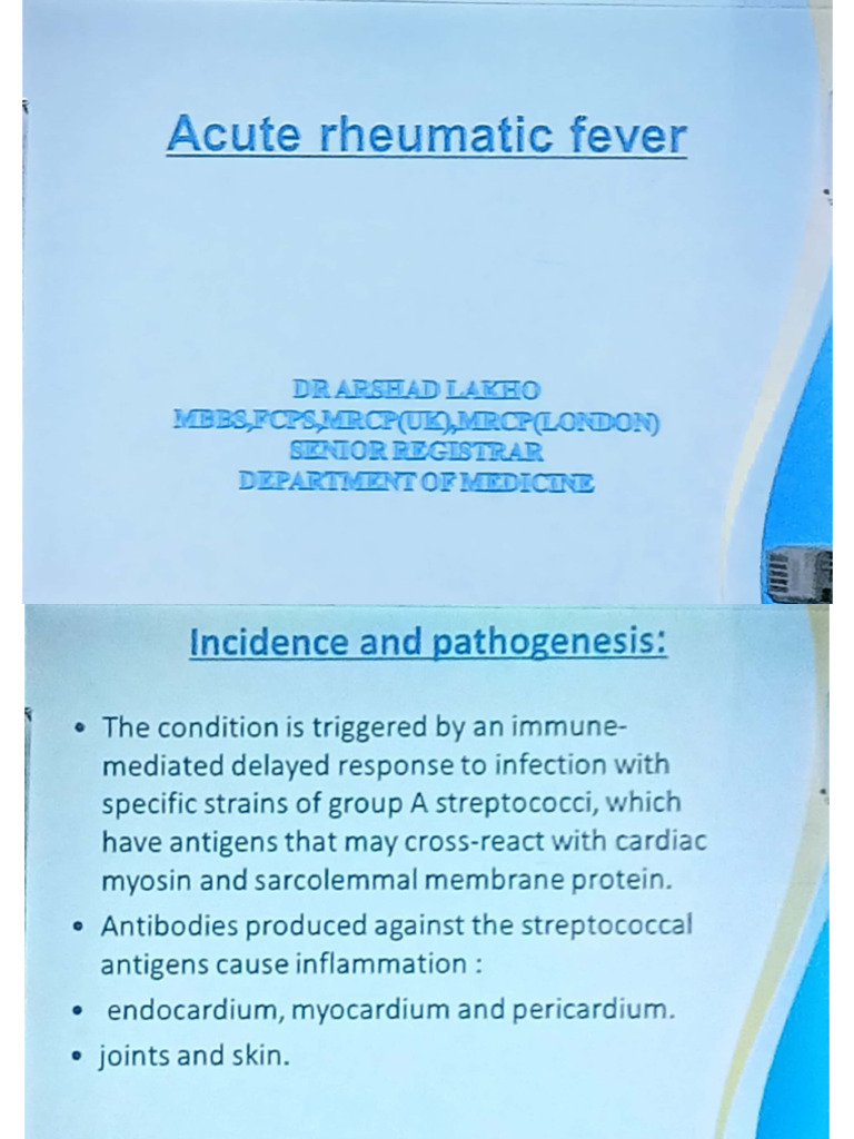 Acute Rheumatic Fever (1) | PDF