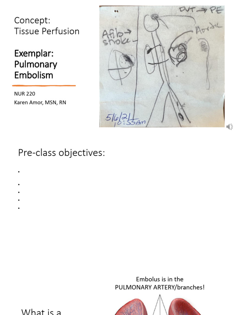 Pulmonary Embolism Pre Class With Notes | PDF | Diseases And Disorders ...