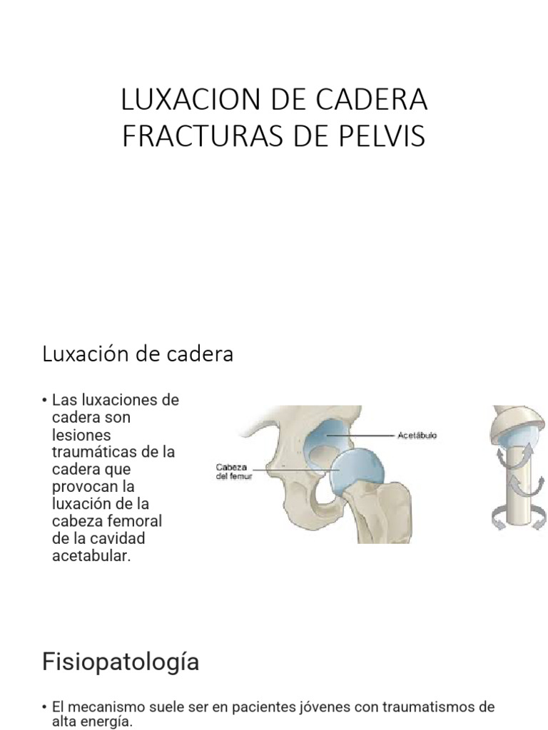 Luxacion de Cadera y Fracturas de Pelvis 6 | PDF | Rodilla ...