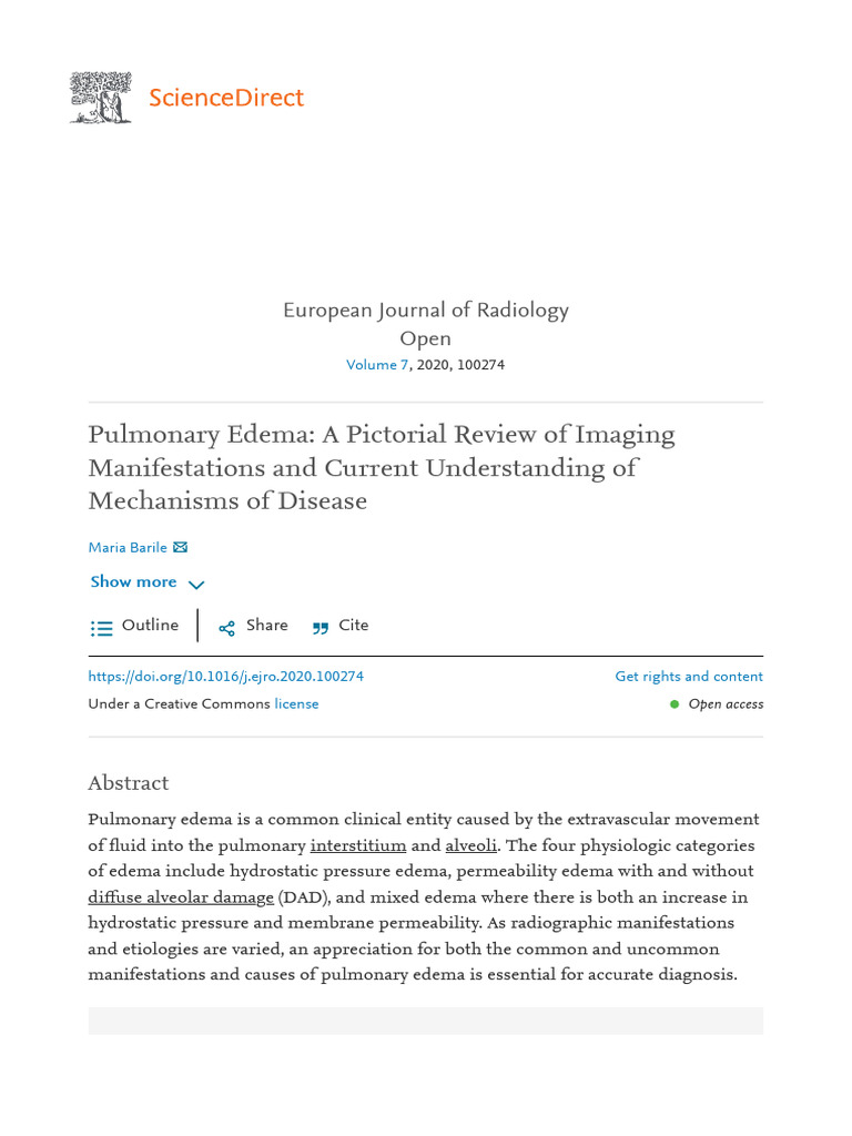 Pulmonary Edema- A Pictorial Review of Imaging Manifestations and ...