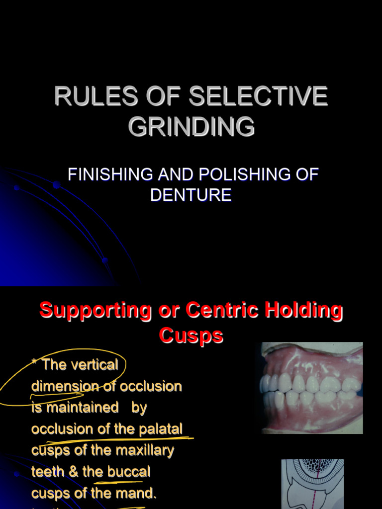 10-Rules of Selective Grinding | PDF | Anatomical Terms Of Location ...