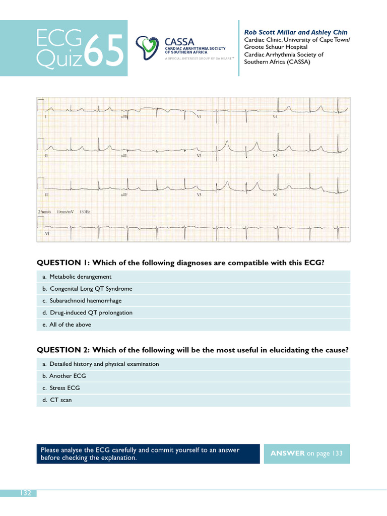 ECG Quiz | PDF