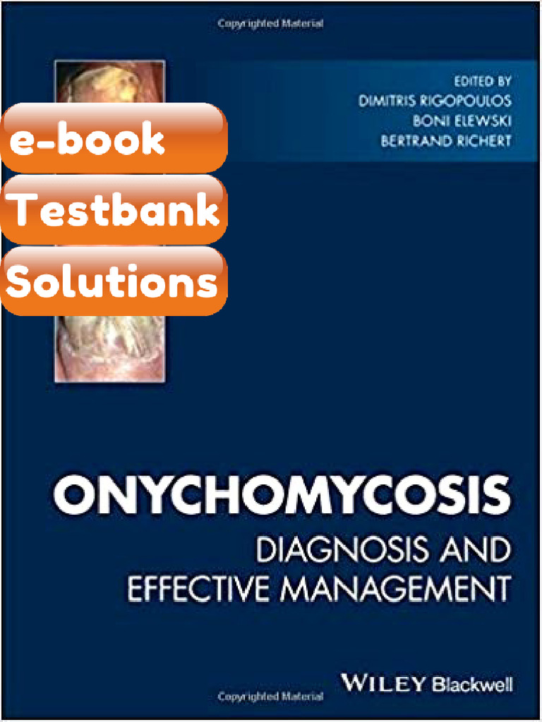 Ebook & Testbank Onychomycosis Diagnosis and Effective Management by ...