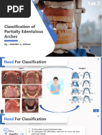 Overview of Kennedy Classification | PDF | Dentures | Tooth
