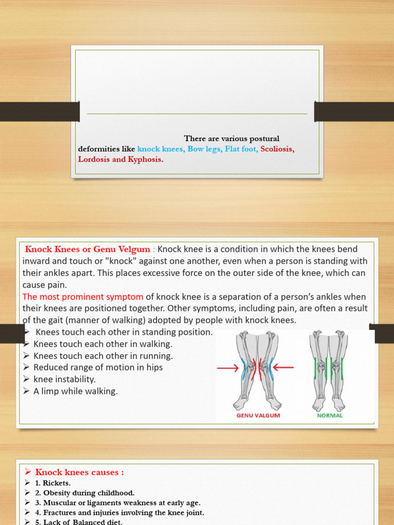 Common Postural Deformities | PDF | Foot | Knee
