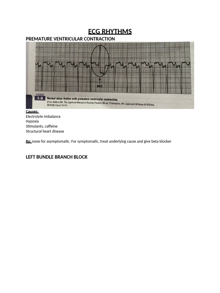 Ecg Rhythms | PDF | Cardiovascular Physiology | Diseases And Disorders