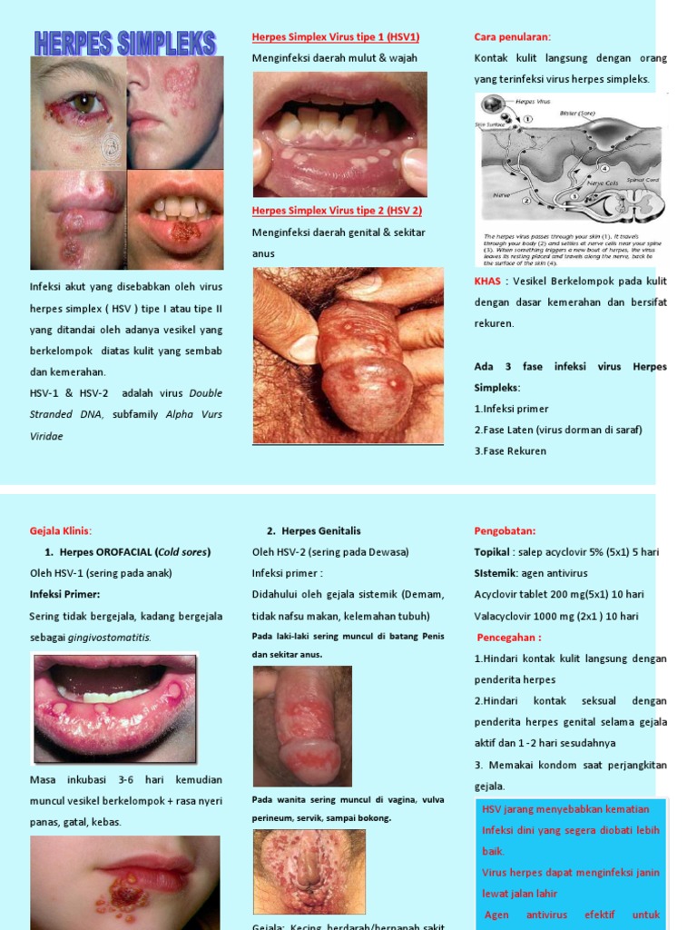 Brosur Herpes Simpleks | PDF
