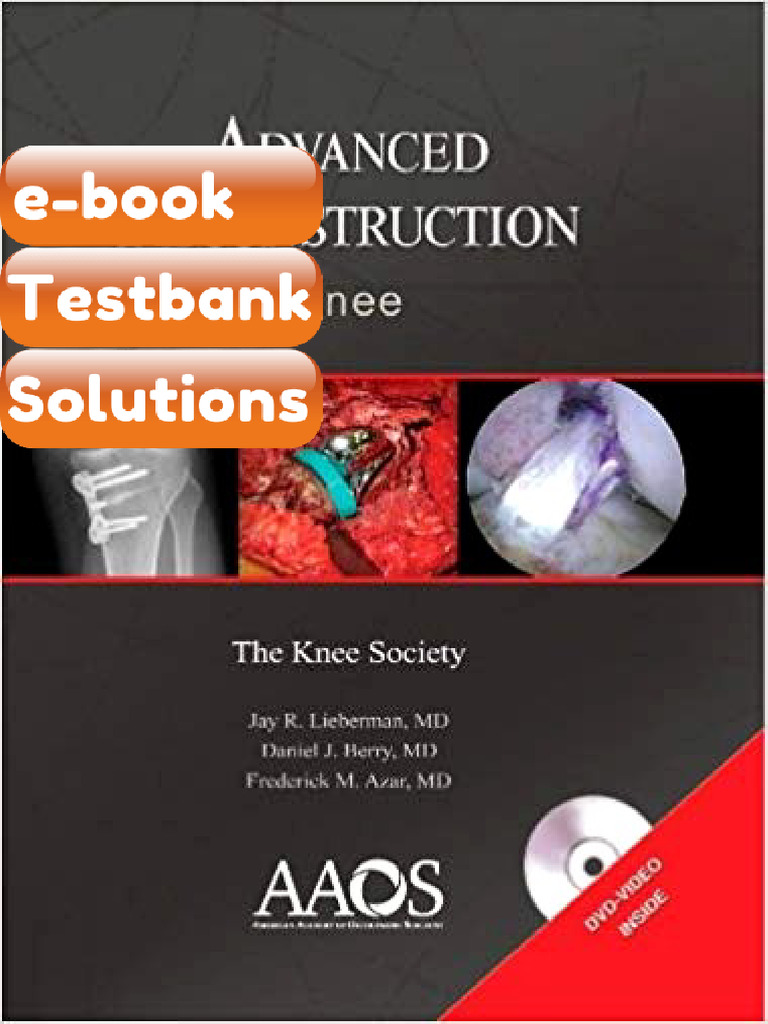 eBook & Testbank Adcanced Reconstruction Knee by Jay R Lieberman Daniel ...