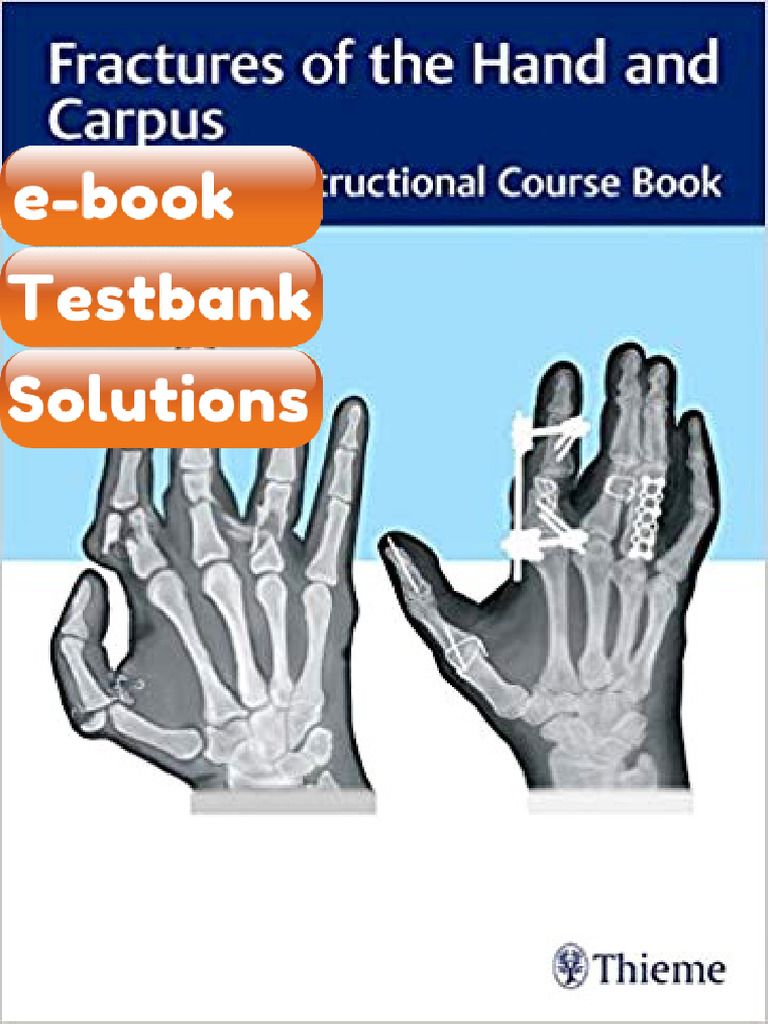 eBook & Testbank Fractures of the Hand and Carpus by Michel EH ...
