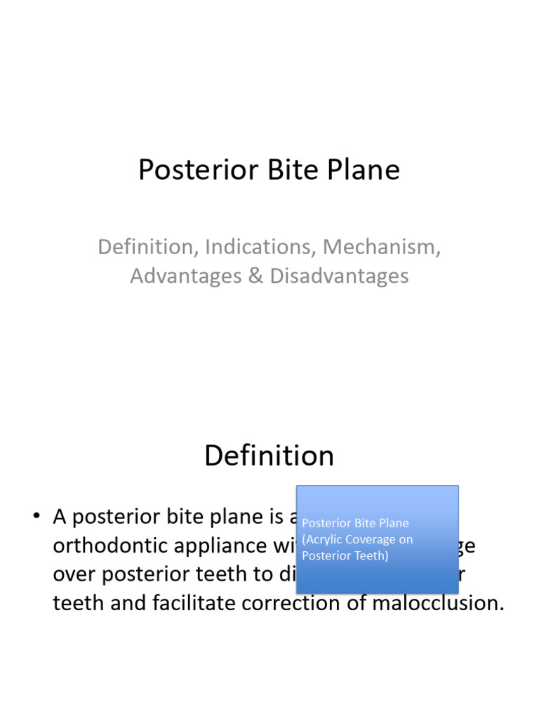 Posterior Bite Plane | PDF