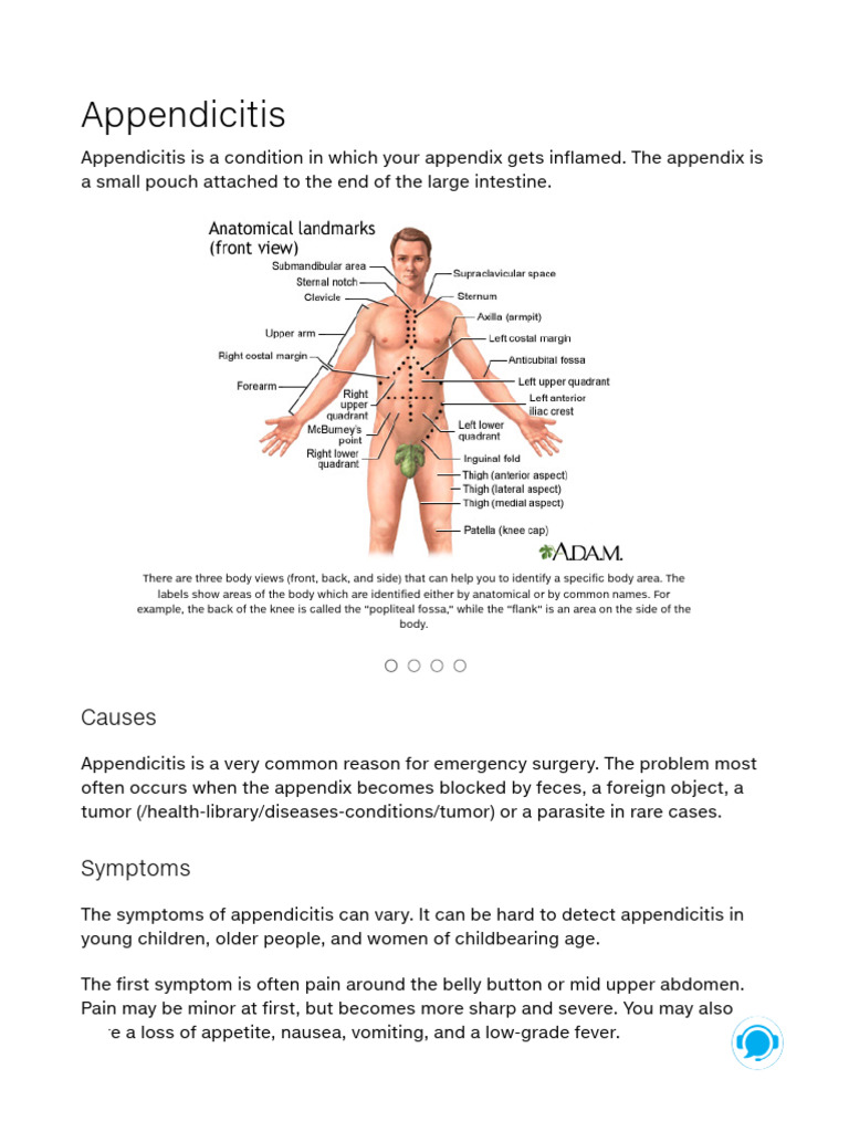 Appendicitis Information _ Mount Sinai - New York | PDF | Digestive ...