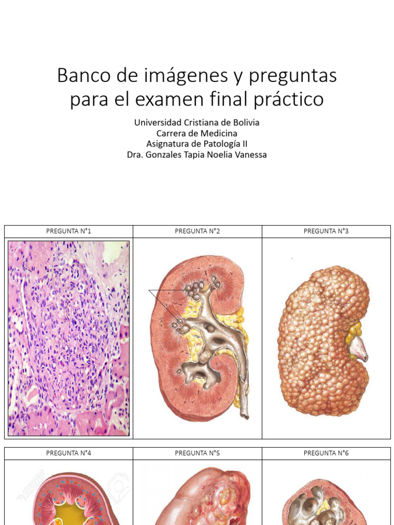 Banco de imágenes y preguntas para el examen EXAMEN FINAL_Hígado_Riñón ...