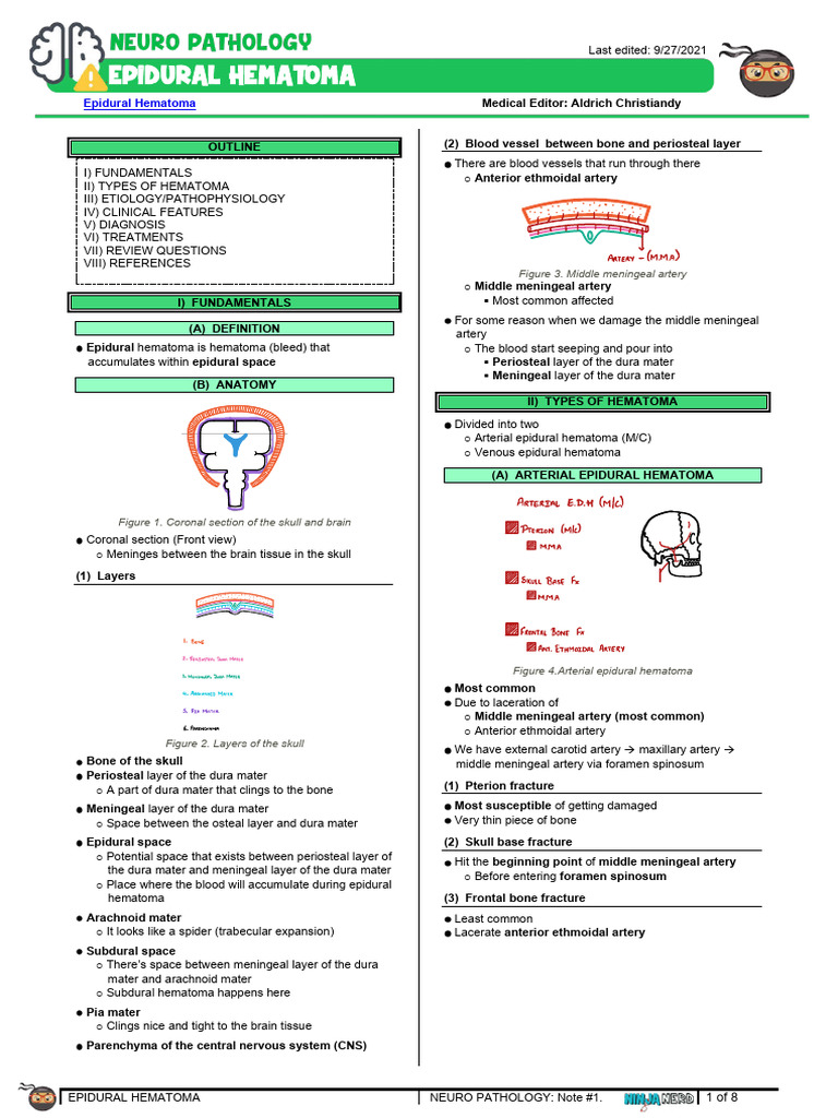 Epidural Hematoma Anatomy, Etiology, Pathophysiology, Clinical Features ...