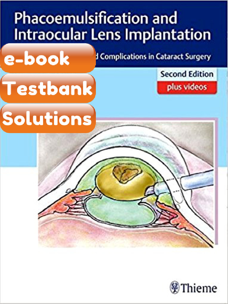 Testbank - Phacoemulsification and Intraocular Lens Implantation 2nd ...