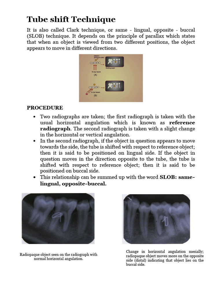 Slob Technique | PDF