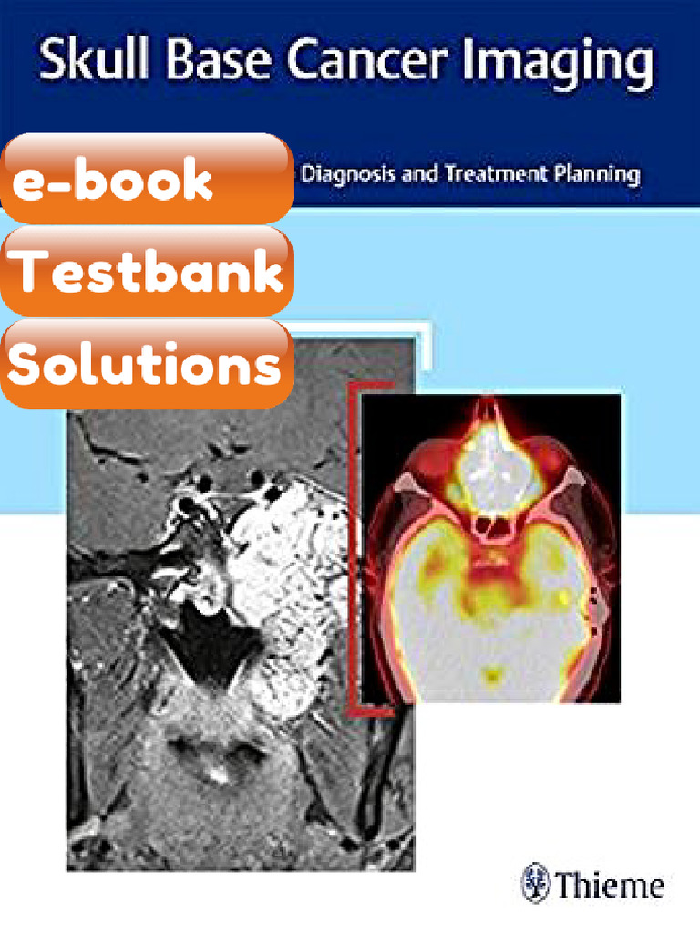 Testbank - Skull Base Cancer Imaging the Practical Approach to ...