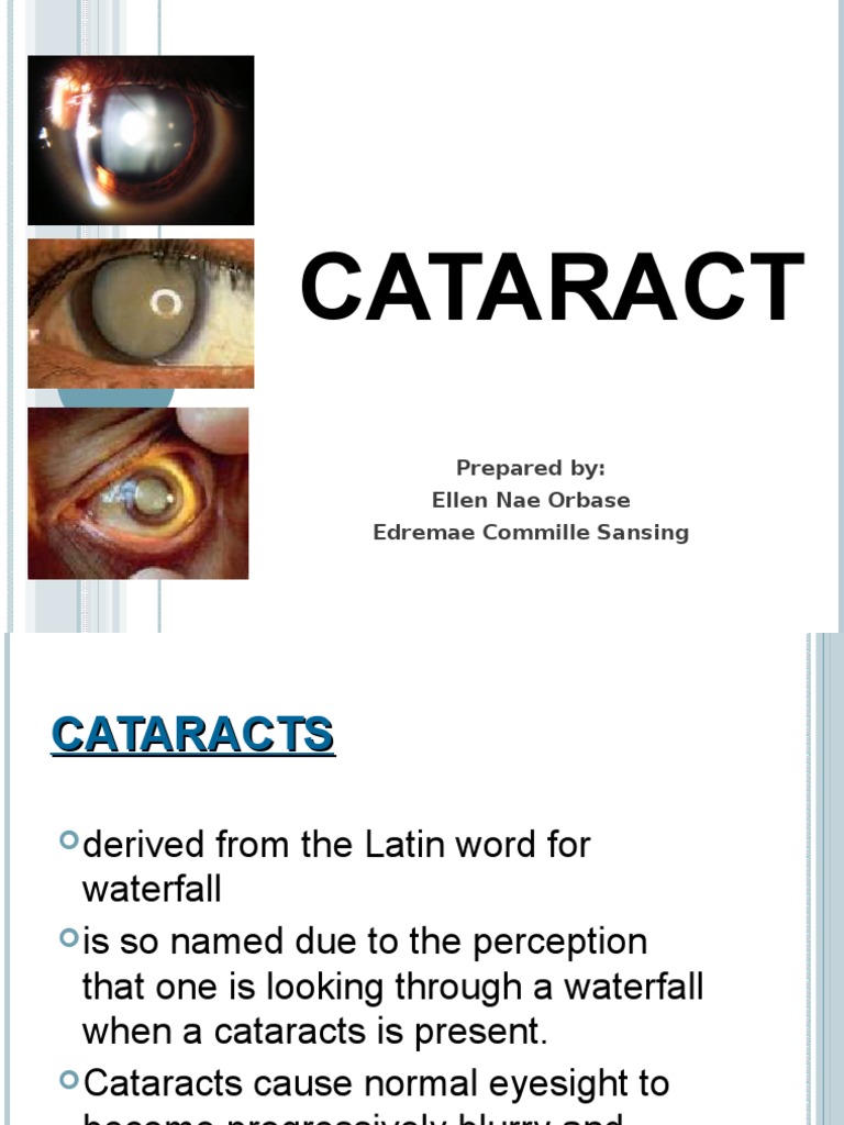 Cataract | PDF | Cataract | Sunglasses