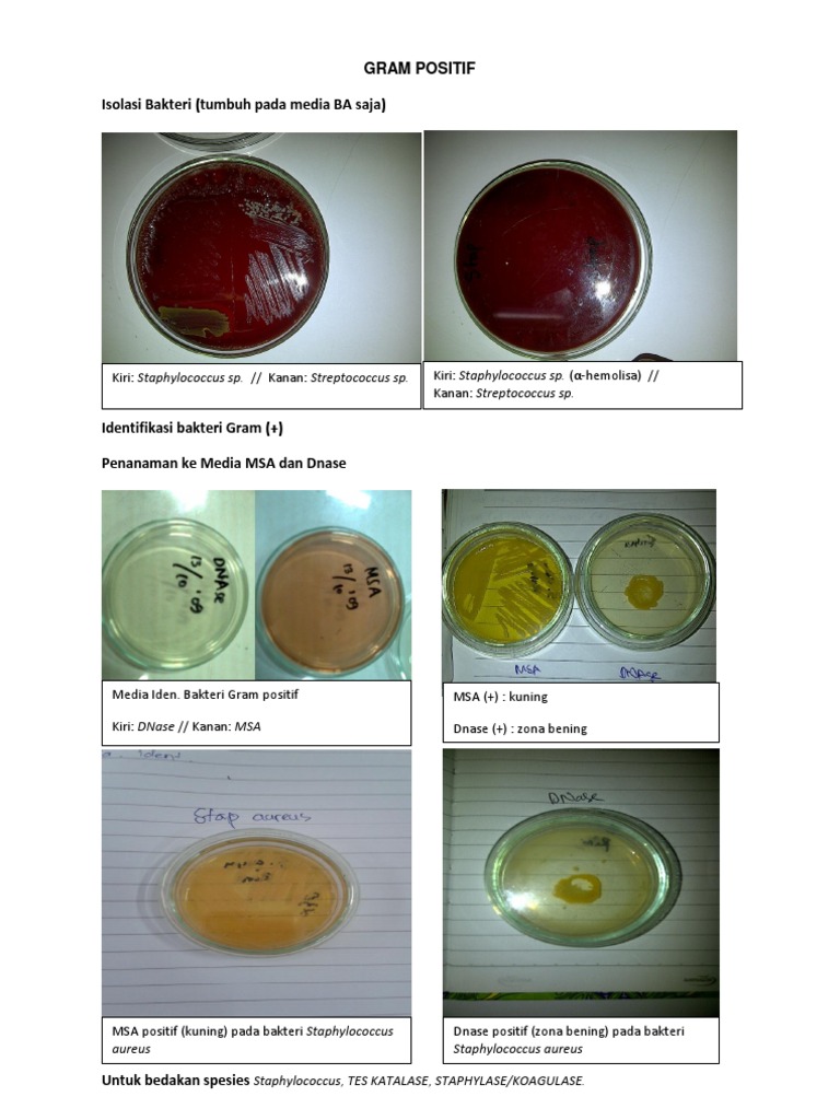Isolasi Dan Identifikasi Bakteri | PDF