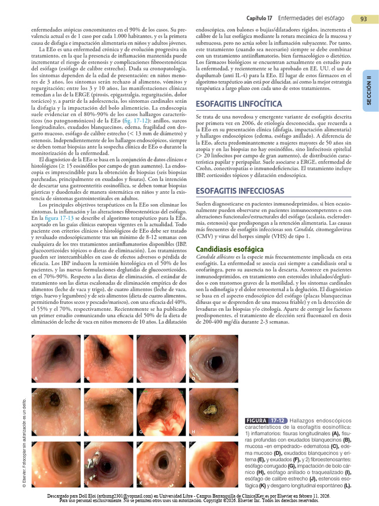 Esofagitis Infecciosa - Farrea Medicina Interna | PDF | La enfermedad ...