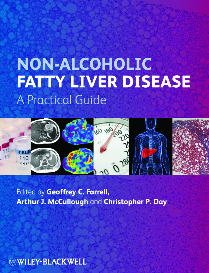 Non-Alcoholic Fatty Liver Disease by Geoffrey C. Farrell, Arthur J ...