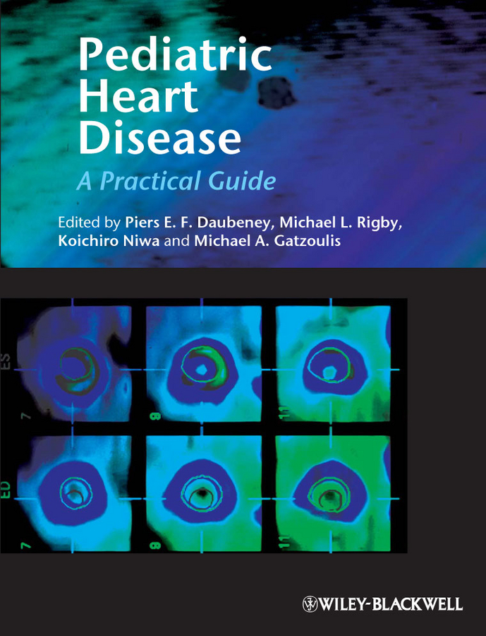 Pediatric Heart Disease by Wiley - Ebook | Everand